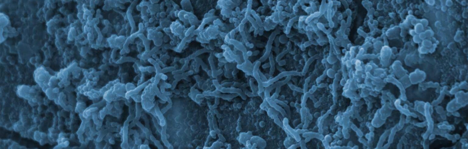 Antimicrobial Testing & Biofilm Solutions in Canada, U.S | Innovotech